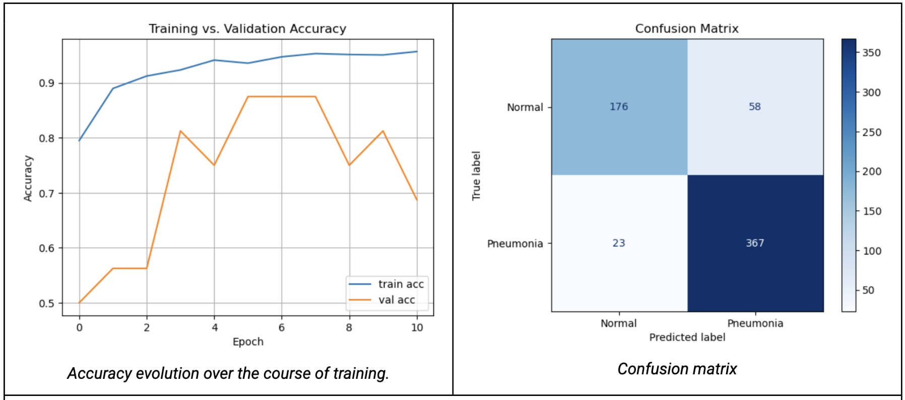 Explainable AI Part 5: Introduction to LIME